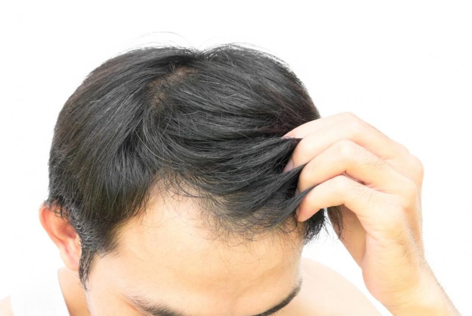 Men’s Guide To A Healthy Scalp: Essential Tips And Tricks | Health By Helen
